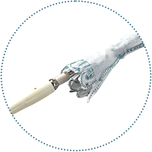 RelayPro | Uniquely Inspired for Ideal Placement