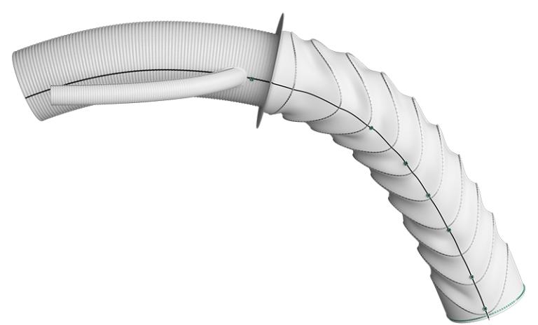 Thoraflex Hybrid | Conforming Aortic Arch Surgery to the Gold Standard