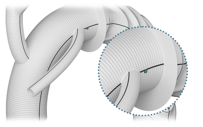 Custom Thoraflex Hybrid | Terumo Aortic