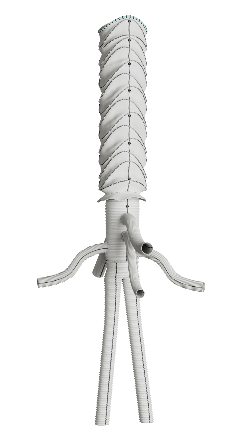Terumo Aortic announces first implant of innovative custom-made ...