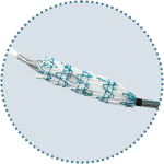 Fenestrated TREO | Advancing Fenestrated Horizons