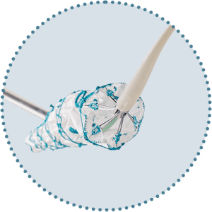 Fenestrated TREO® | Terumo Aortic