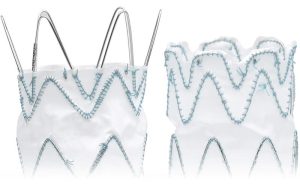 RelayPro | Uniquely Inspired for Ideal Placement