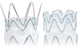 Relay®Pro | Terumo Aortic