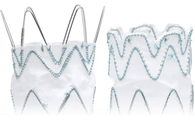 Relay®Pro | Terumo Aortic