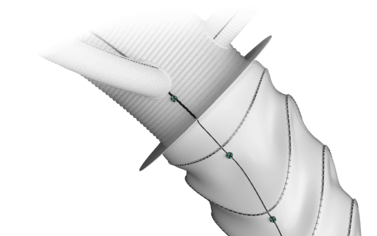 Thoraflex™ Hybrid | Terumo Aortic