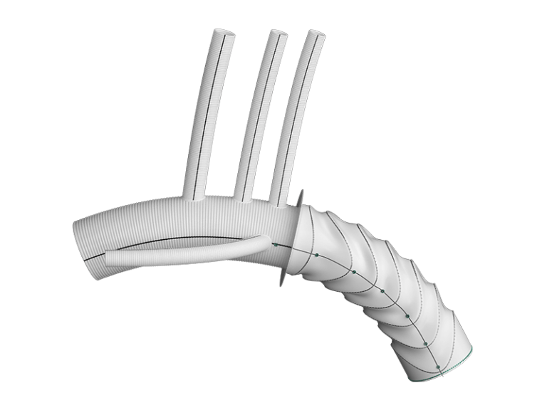 Terumo Aortic announces first commercial implant of the Thoraflex ...