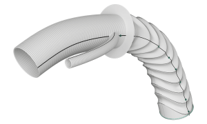 Thoraflex Hybrid | Conforming Aortic Arch Surgery to the Gold Standard