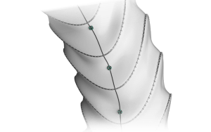 Thoraflex Hybrid | Terumo Aortic