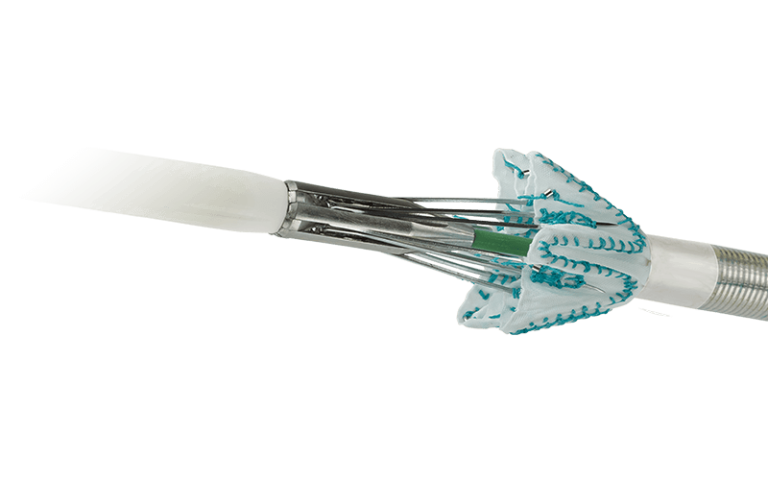 TREO | Versatile by Design. Fit for any Anatomy.*