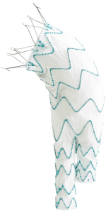 TREO | Versatile by Design. Fit for any Anatomy.*