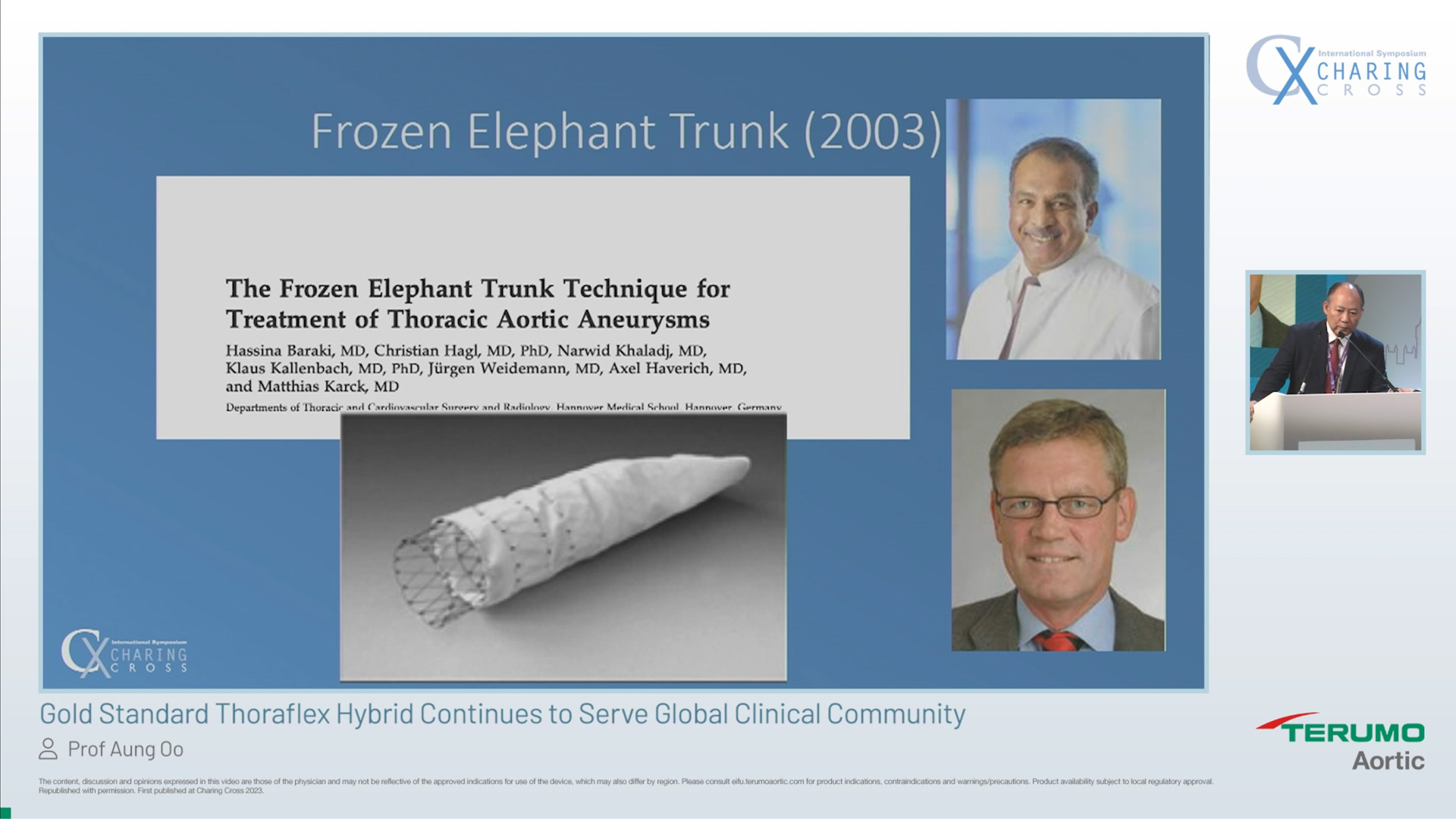 Gold Standard Thoraflex Hybrid Continues to Serve Global Clinical ...