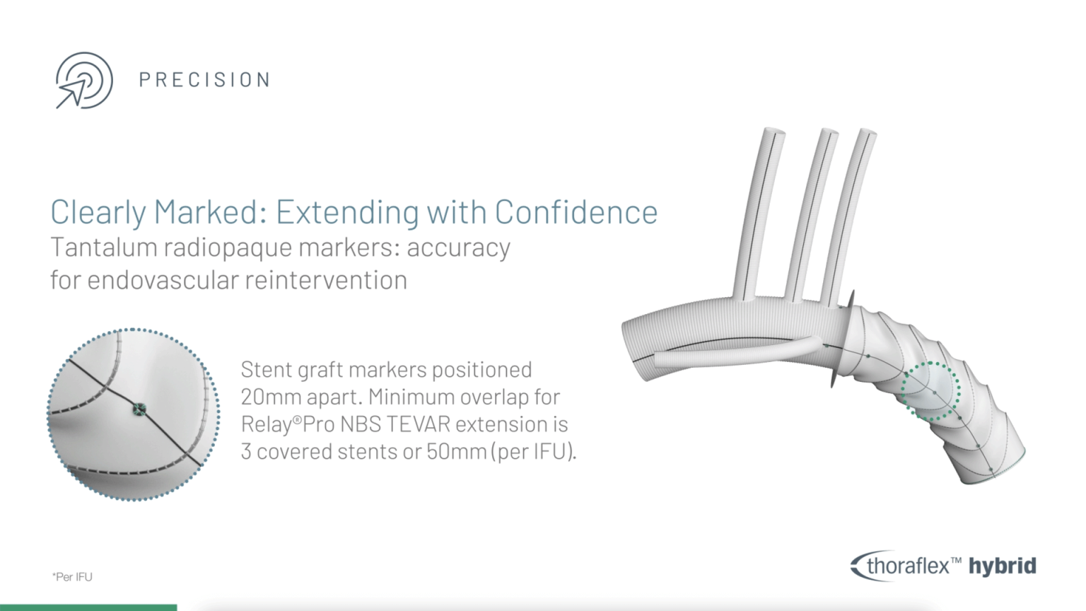 Aortic Repair Solutions | Terumo Aortic