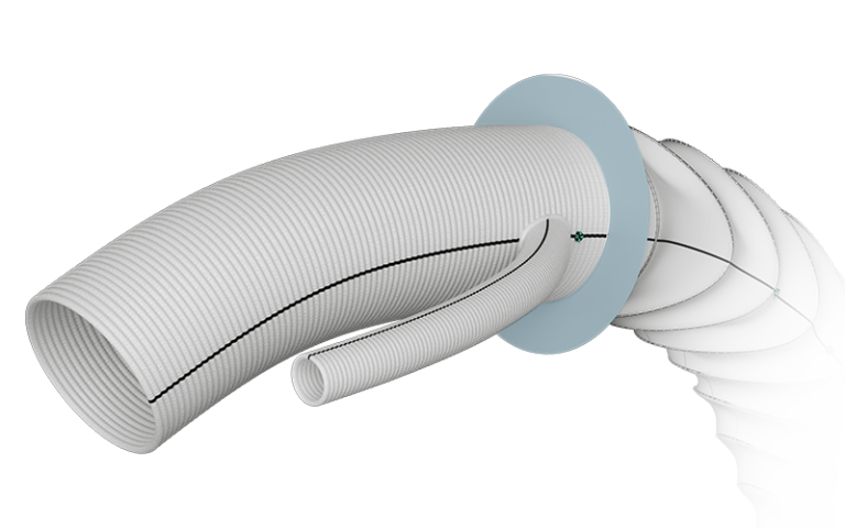 Thoraflex Hybrid | Conforming Aortic Arch Surgery to the Gold Standard
